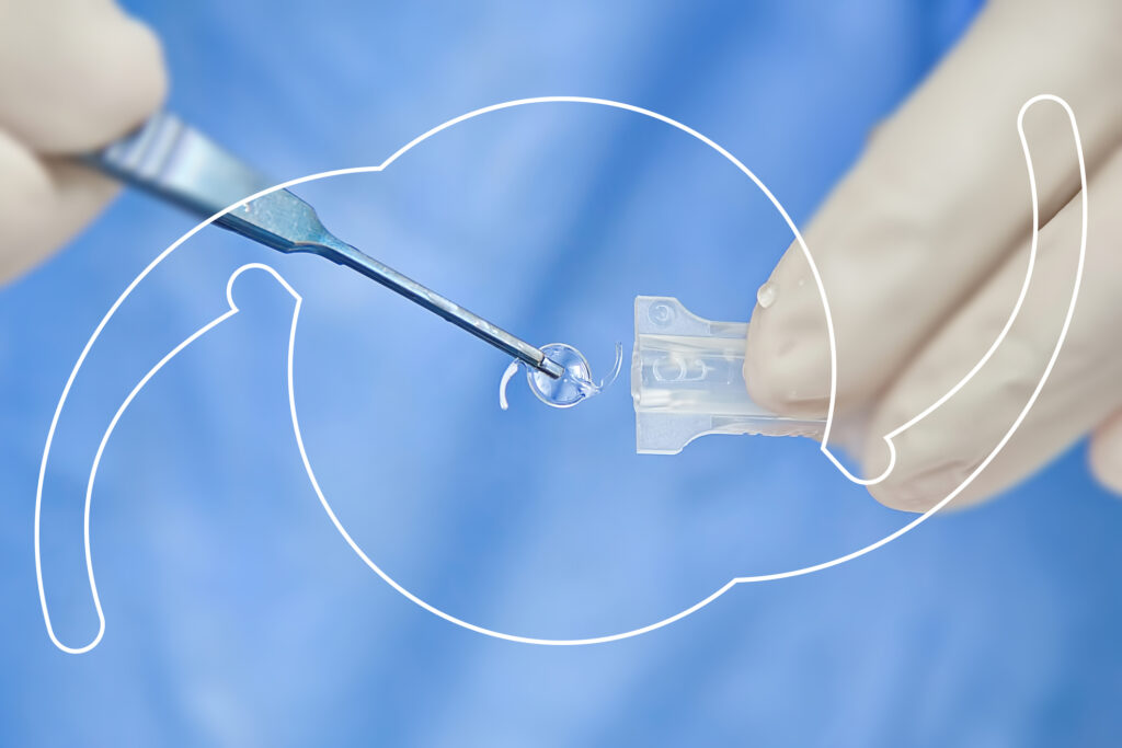 Intraocular Lenses – Care Group Global